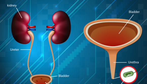 Know About The Types of Urinary Tract Infection | Teja Kidney Care